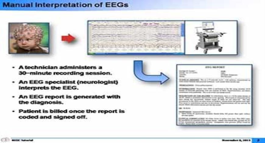 Download Free Medical Manual Interpretation of EEGs-A Machine Learning ...