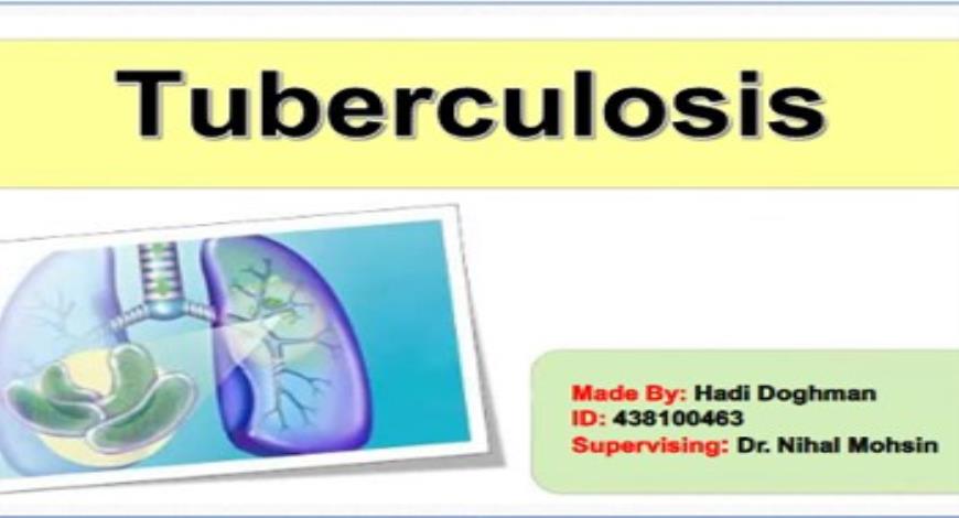 Download Medical Notes on Tuberculosis