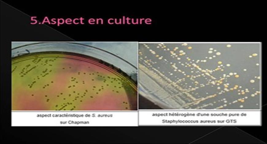 Download Free Medical Antibiogramme Des Staphylocoques PowerPoint ...