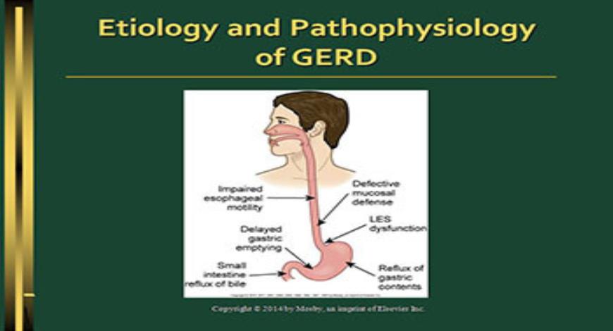 Download Free Medical GERD Case Study PowerPoint Presentation