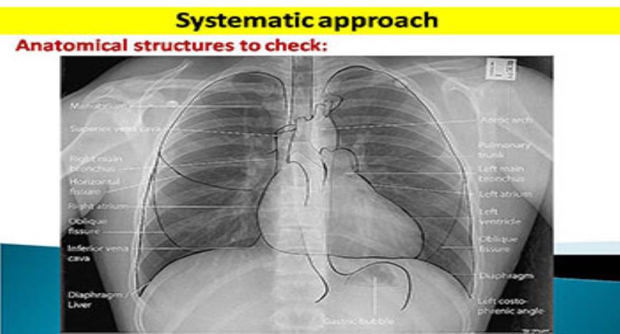 Download Free Medical Radiology Chest X-ray-Systematic Approach ...