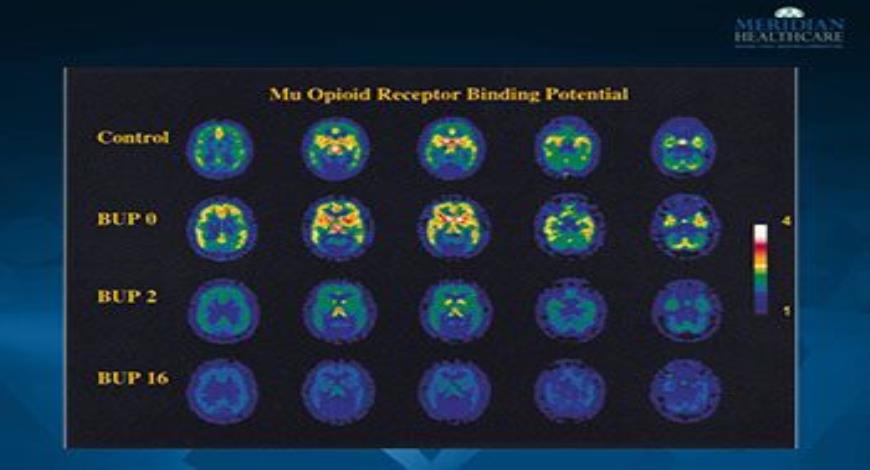 Download Free Medical Medication Assisted Treatment PowerPoint Presentation