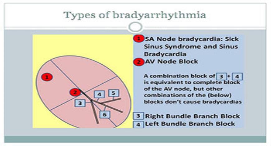 Download Free Medical Arrhythmias PowerPoint Presentation