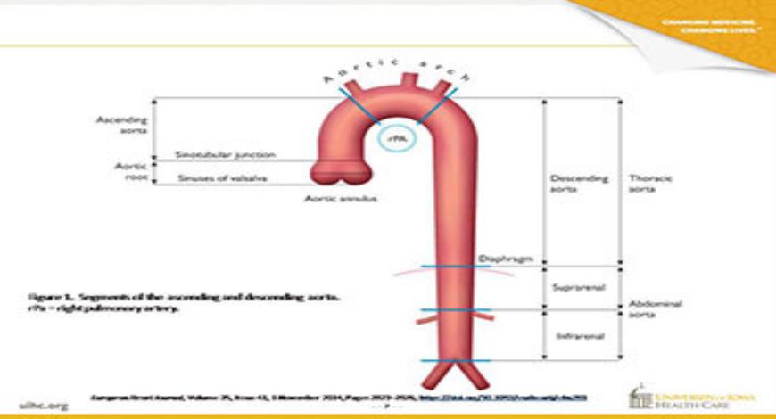 Download Free Medical The Aorta 101 PowerPoint Presentation