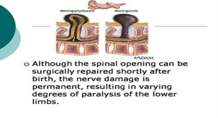 Download Free Medical Birth Defects PowerPoint Presentation
