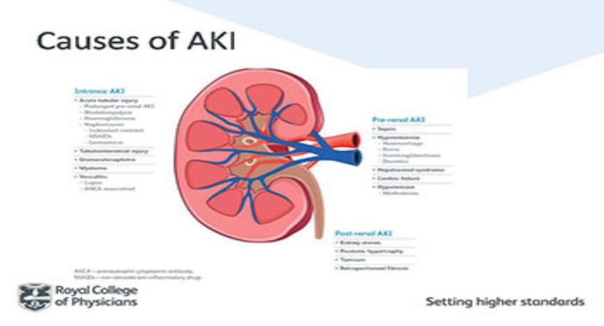 Download Free Medical Acute Kidney Injury and Intravenous Fluid Therapy ...