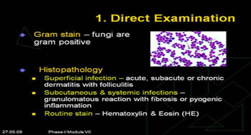Download Free Medical Laboratory Diagnosis of Fungal Infections ...