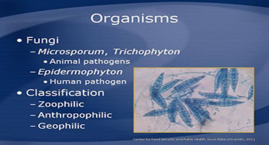 Download Free Medical Dermatophytosis PowerPoint Presentation