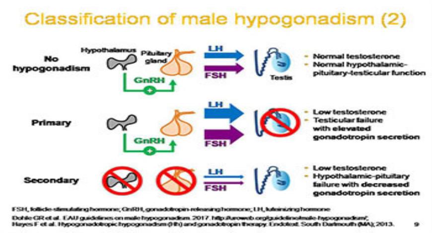 Download Free Medical Male Hypogonadism PowerPoint Presentation