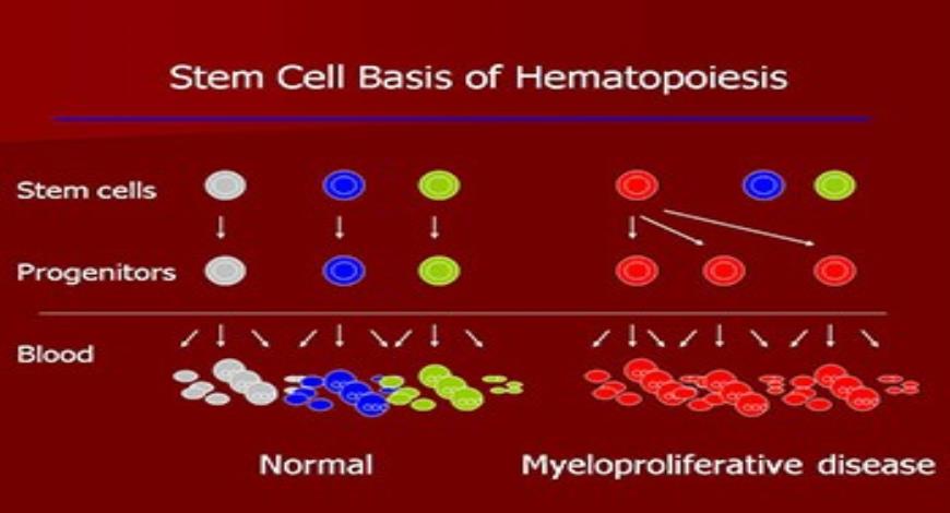 Download Free Medical Thrombocytosis Essential and Reactive PowerPoint ...