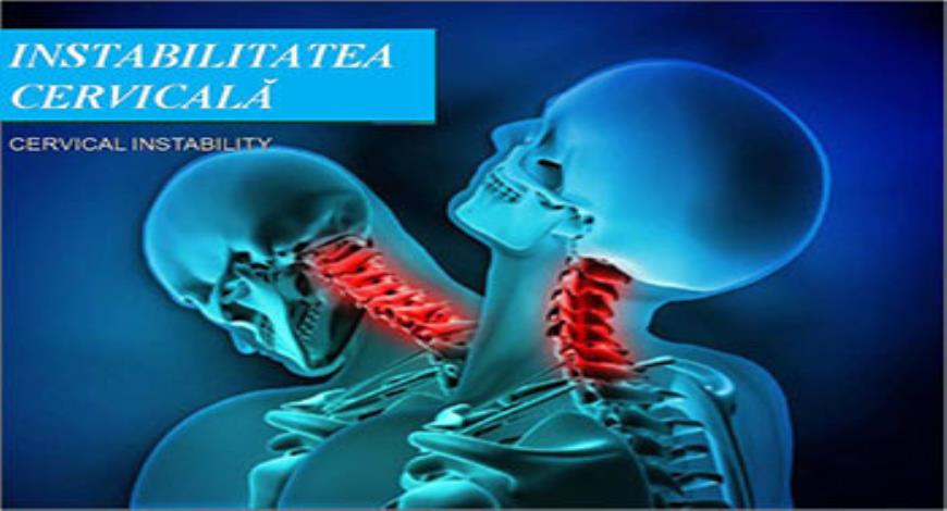 Download Free Medical Instabilitate Cervicala PowerPoint Presentation