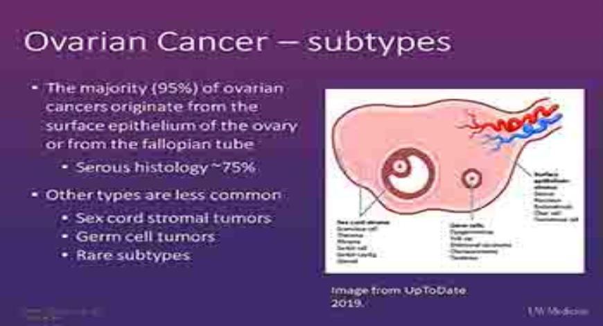 Download Free Medical Ovarian Cancer 101 PowerPoint Presentation