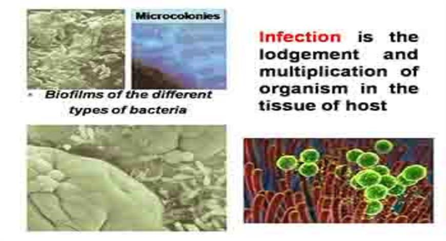 Download Free Medical Infection And Infectious Process Powerpoint