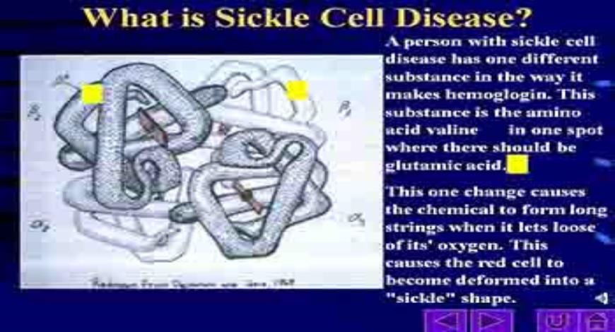 Download Free Medical What Is Sickle Cell Disease PowerPoint Presentation