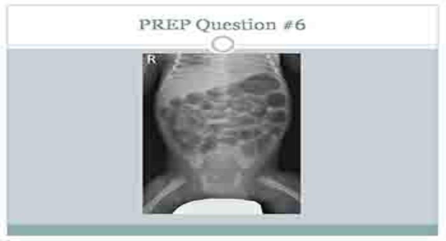 Download Free Medical Primary Care of The Preterm Infant PowerPoint ...