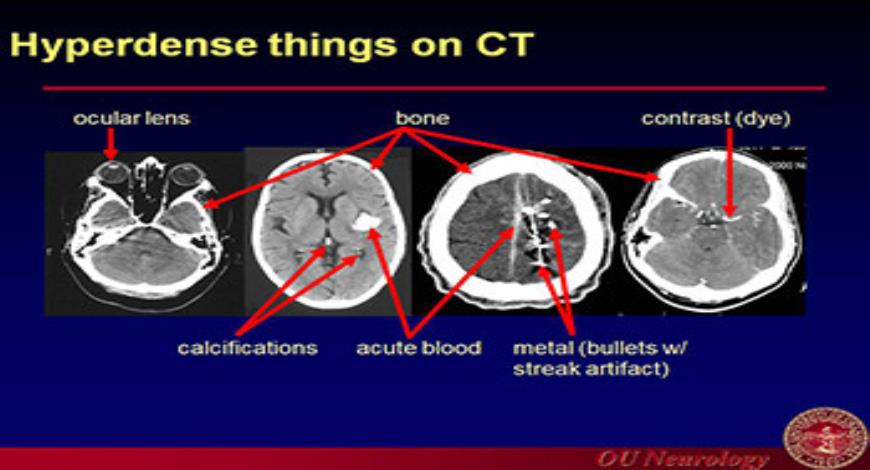 Download Free Medical Introduction To Head Ct Imaging PowerPoint ...