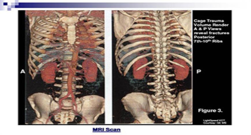 Download Free Medical The Role of Medical Imaging Informatics In ...