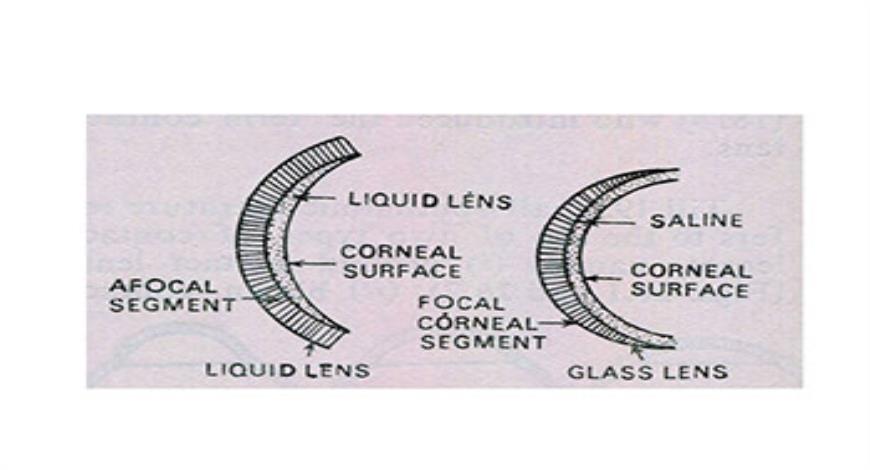Download Free Medical Optics of Contact Lenses PowerPoint Presentation