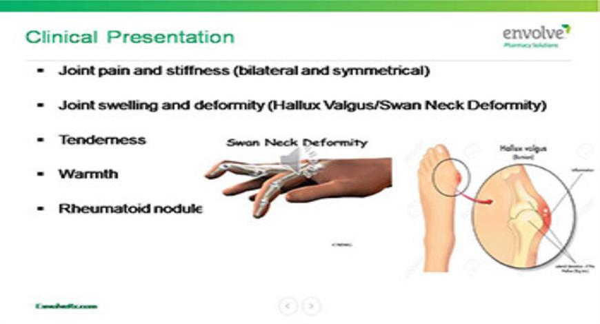 Download Free Medical Rheumatoid Arthritis-RA-Management PowerPoint ...