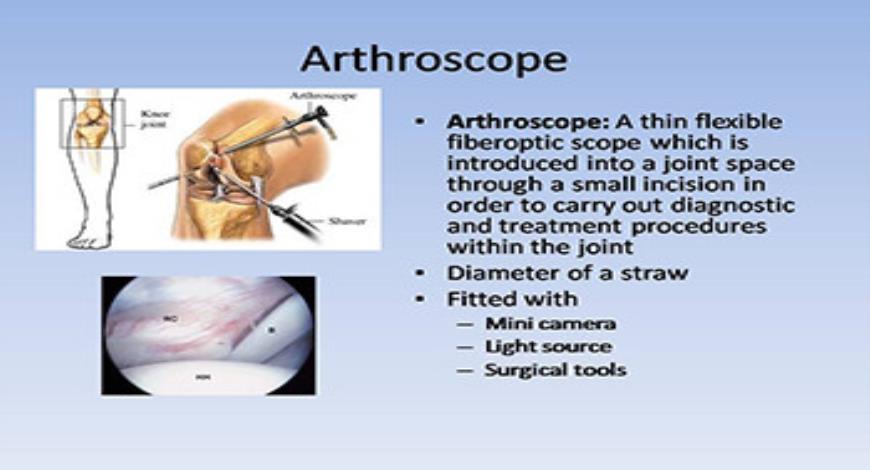 Download Free Medical Arthroscopy PowerPoint Presentation
