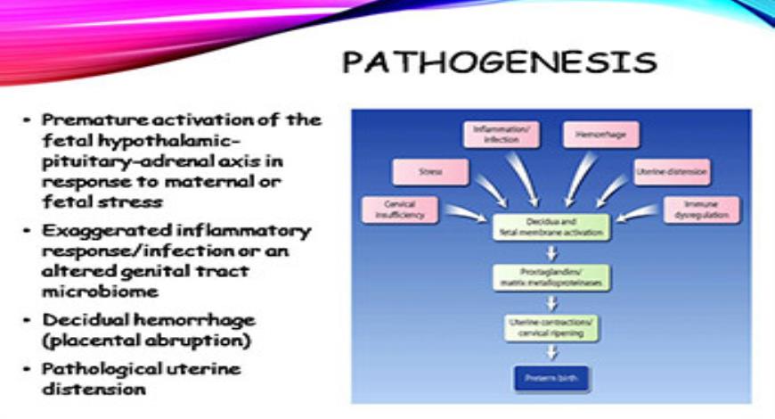 Download Free Medical preterm labour PowerPoint Presentation