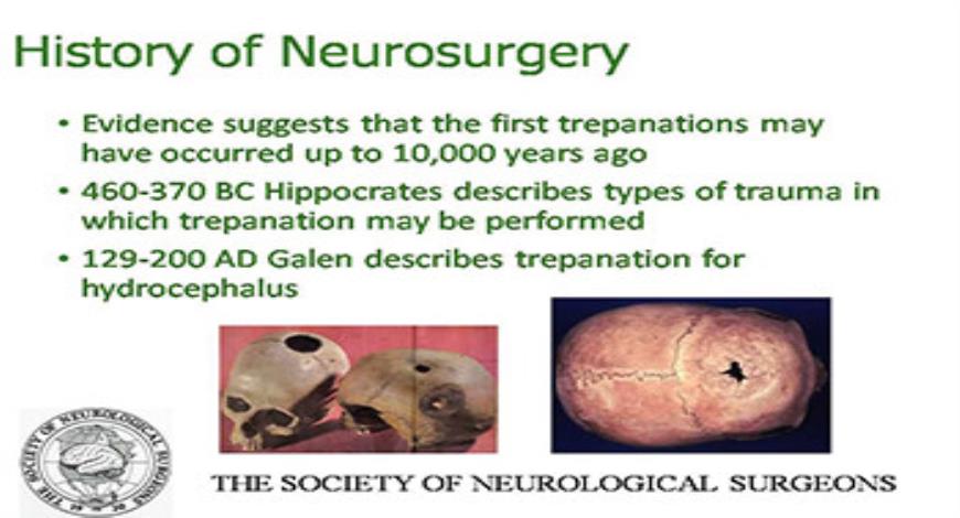 Download Free Medical Introduction to Neurosurgery PowerPoint Presentation