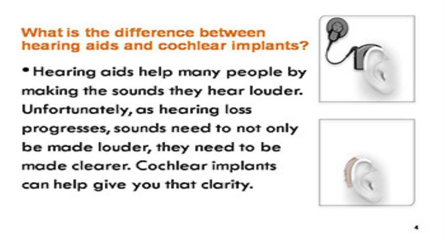 Download Free Medical The Cochlear Implant PowerPoint Presentation