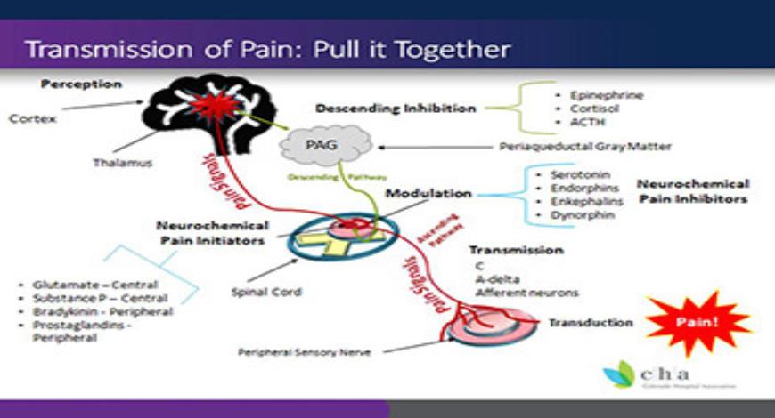 Download Free Medical The Anatomy and Physiology of Pain PowerPoint ...