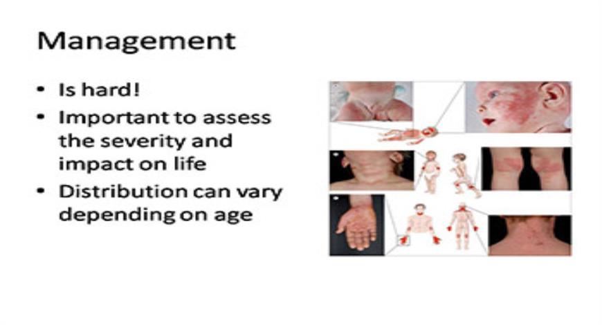 Download Free Medical Atopic Eczema in Children PowerPoint Presentation