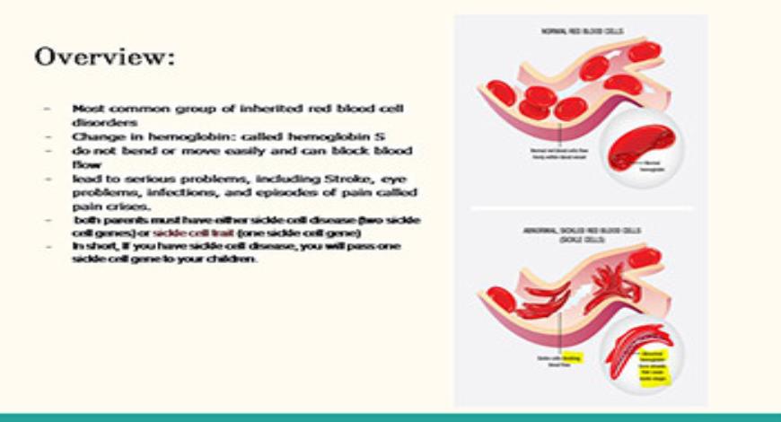 Download Free Medical Sickle Cell Anemia PowerPoint Presentation