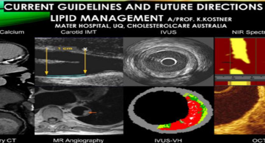 Download Medical Notes on Lipid Management
