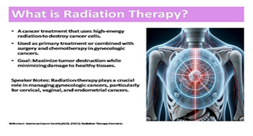 Radiation Therapy in Gynecologic Oncology | Medicpresents.com
