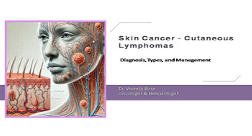 Skin Cancer - Cutaneous Lymphomas | Medicpresents.com
