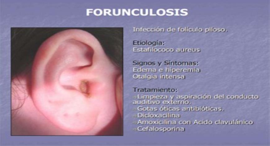 Download Medical Notes on OTALGIA