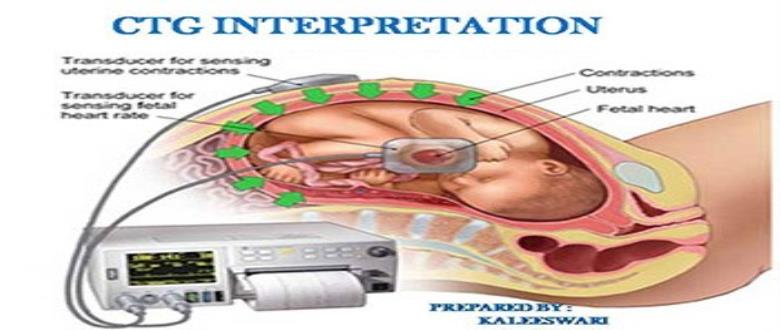 Download Free Medical CTG interpretation PowerPoint Presentation
